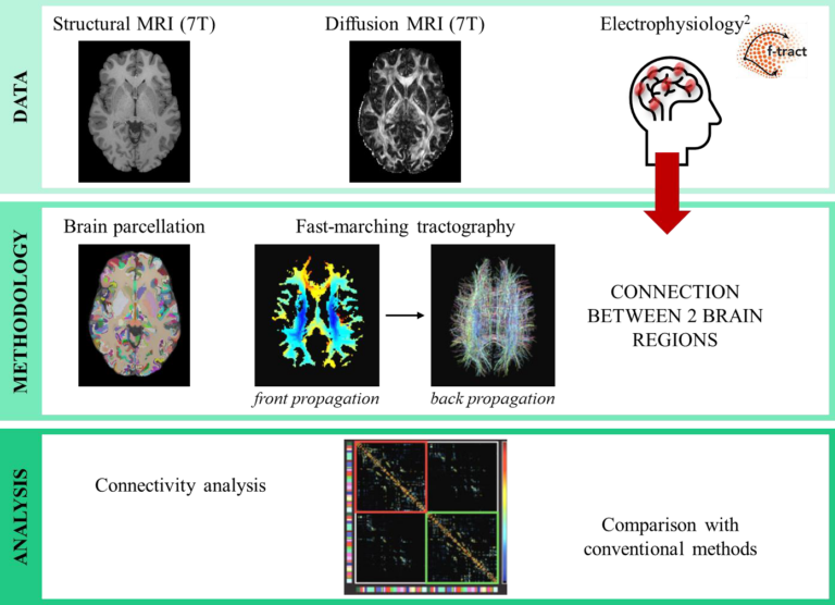 Structural connectivity of the human brain: what can we learn from ...
